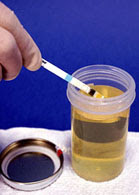 DICAS DA SABEDORIA POPULAR: URINA COLORIDA ( URINA VERDE, ROXA, LARANJA ...