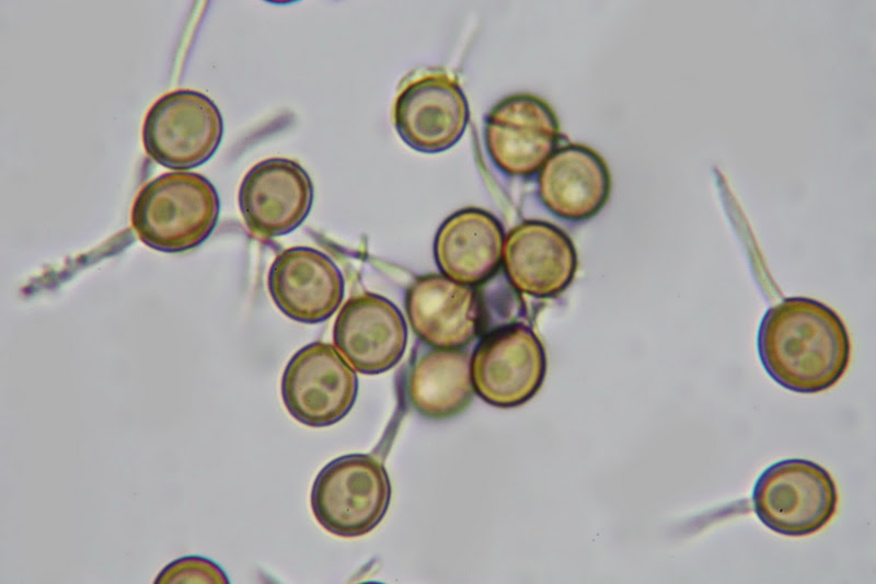 El mundo microscópico de los hongos: Gasteromicetos