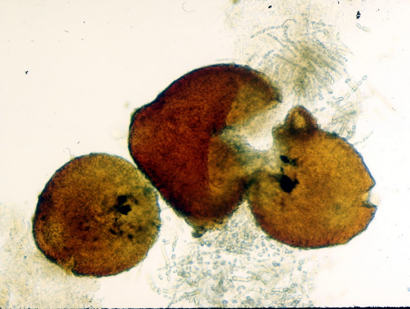 El mundo microscópico de los hongos: Ascomicetos