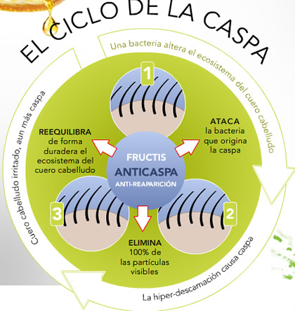 LITTLE WING: Cómo convivir con la caspa