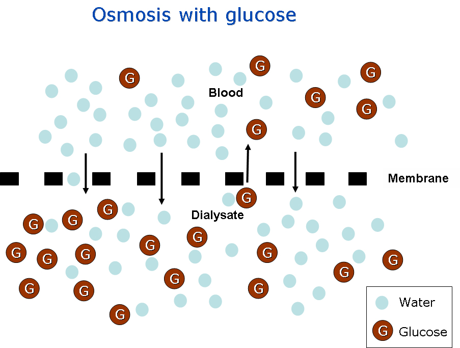 Scientific Principles Used in Dialysis