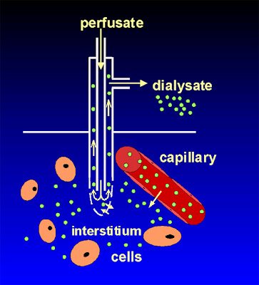 Hemodialysis Devices: Dialysate