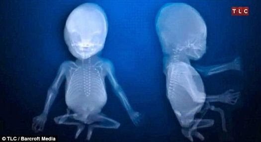 Photograph's and Wallpaper: Man With a Half Body