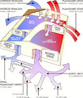 Lily's Pad: Pulmonary Atresia Diagram