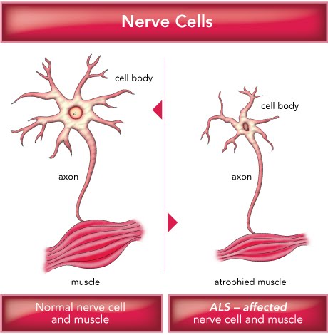 Remembering Curt Ziemke: Diagnosis