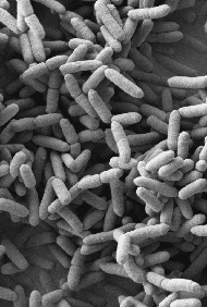 Bacteroides melaninogenicus - Alchetron, the free social encyclopedia