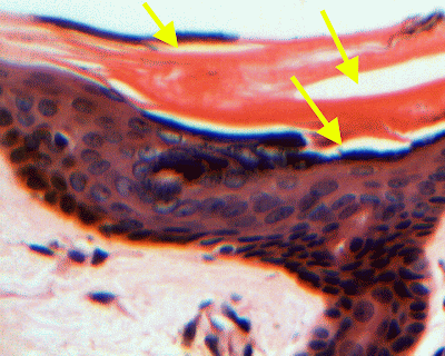 HistoloBlog: Tissue fixation and processing