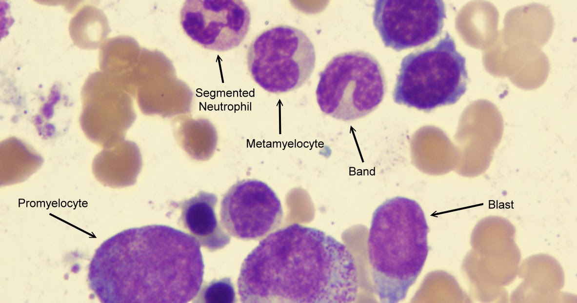 Overview AML for amali | [A] 4apple®