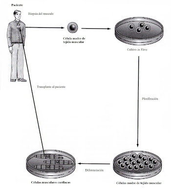 Células Madre y Bioética: Clonaje Terapéutico con células madre de ...