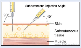 Nursing skills: Subcutaneous Injection