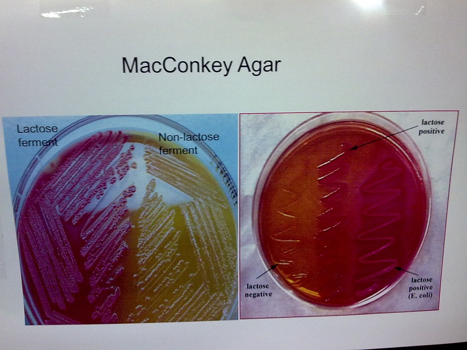 HARPACTIRINAE BIOTECHNOLOGY: Microbes Theoretical result `~~~part 1