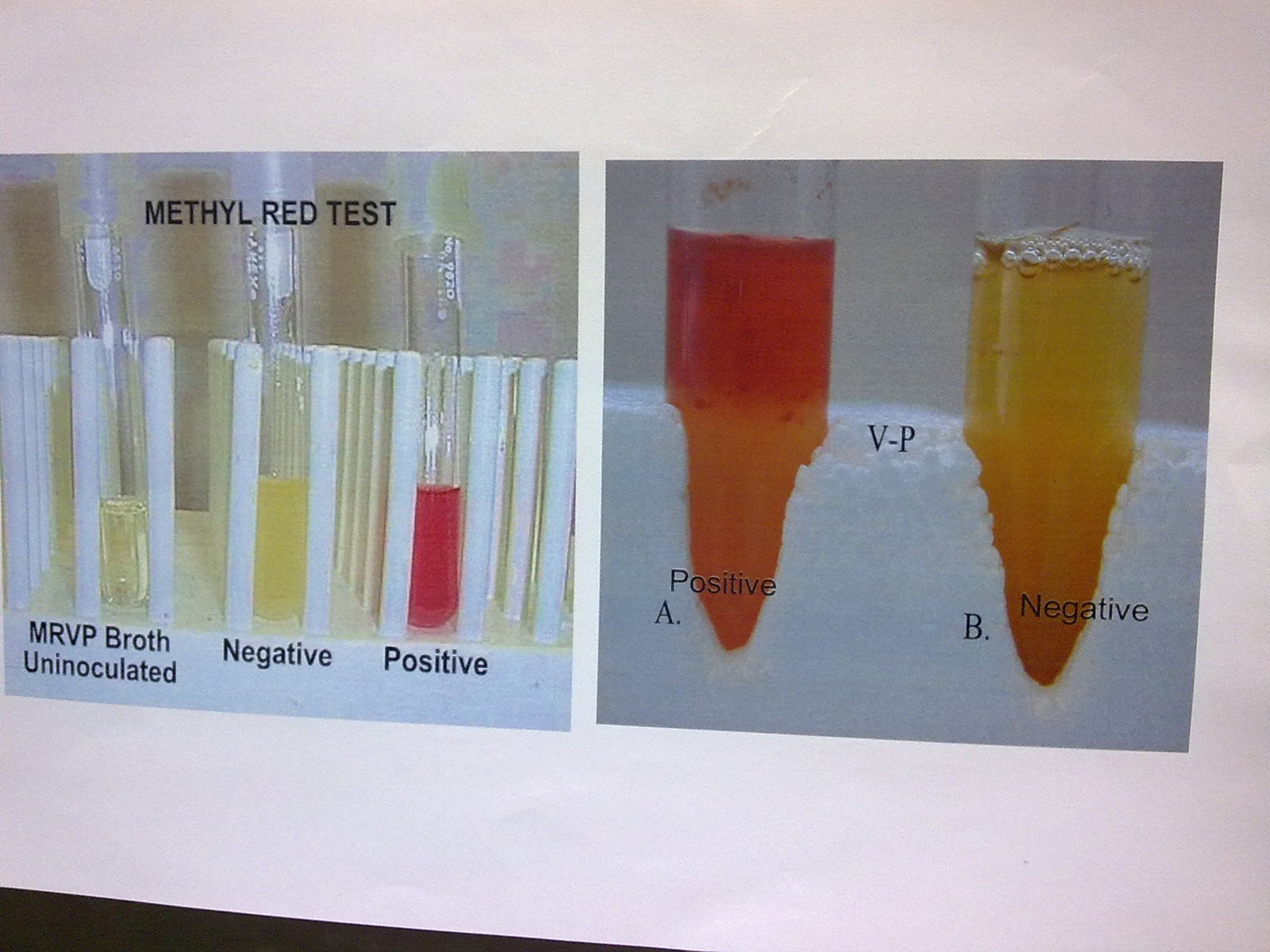 HARPACTIRINAE BIOTECHNOLOGY: Microbes Theoretical result ~~~part 2