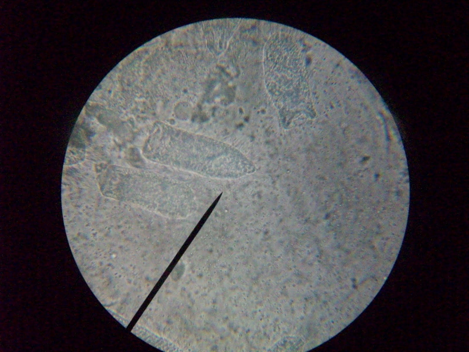 Awesome Science Blog!: Protozoa Lab!