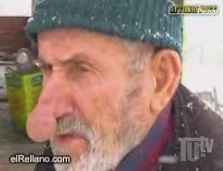 Records mundiales: El más narizón del mundo