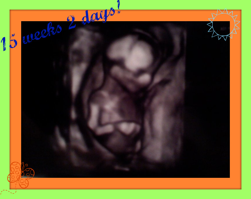 Our Darling Blessing's: 15 Week 2 day Drs.Appt & Ultrasound!