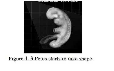 Poker is a hard way to make an honest living......: Fetal Development Lab