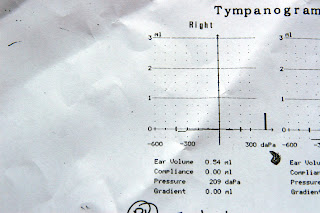 Say What?: The Importance of the Middle Ear