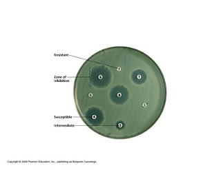 Uji Aktivitas Antibakteri | Spectra of Fairus Zabadi