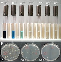 Uji Aktivitas Antibakteri | Spectra of Fairus Zabadi