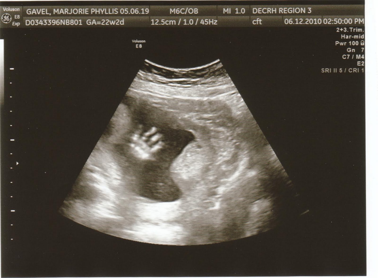 Carrying A Rainbow: 22 weeks + 2 days...Ultrasound with the specialist ...