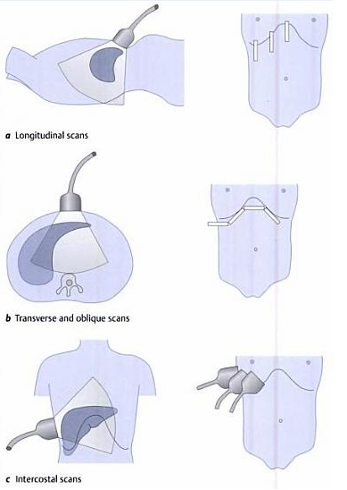 Ultrasound : Liver - Technique