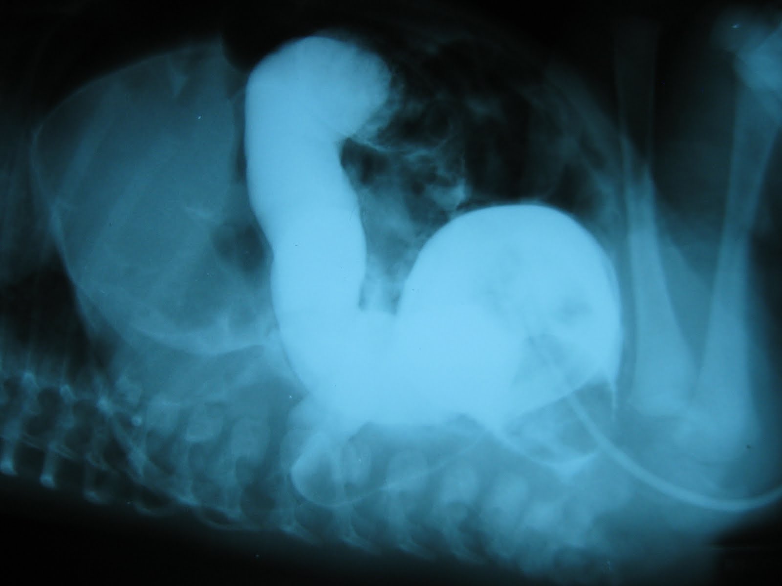 Bedah Anak-RSUD AWS: Komplikasi pemasangan pipa rektal untuk dekompresi ...