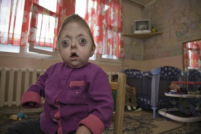 The Darkness within my Lights: Retarded kids