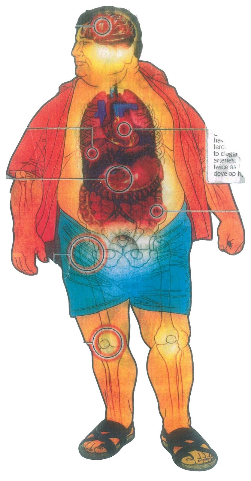 WellnessNOW! Health Talk...: Hidden Fat