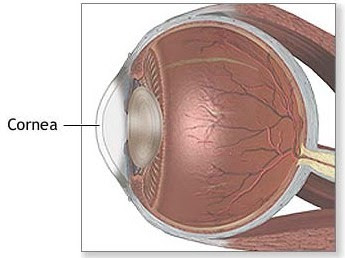 Keratoconus: A New Direction: The Normal Cornea vs. Keratoconus