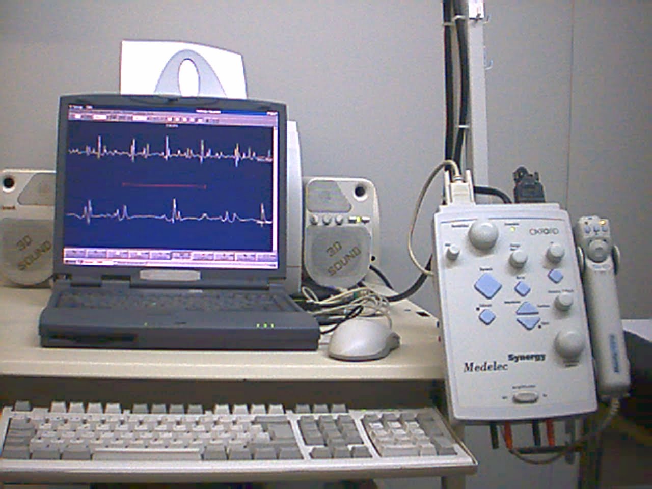 Electromiografía básica