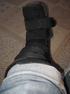 Kate's Peroneus Brevis Tendon Surgery and Recovery: The moon boot