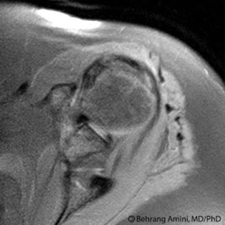 Roentgen Ray Reader: The Buford Complex