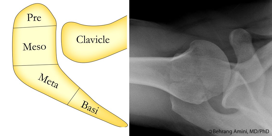 Roentgen Ray Reader: Os Acromiale