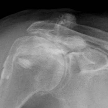 Roentgen Ray Reader: Geyser Sign