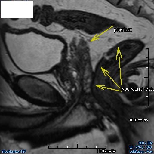 Maya Posch: MRI Mysteries