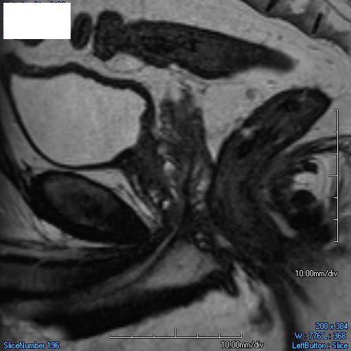 Maya Posch: MRI Mysteries