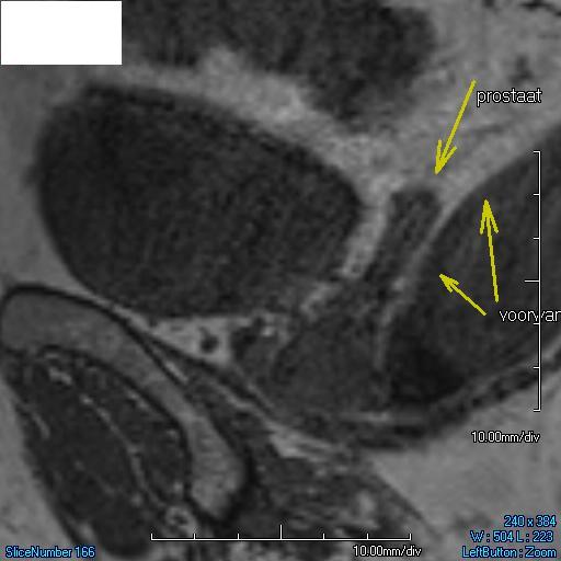Maya Posch: MRI Mysteries