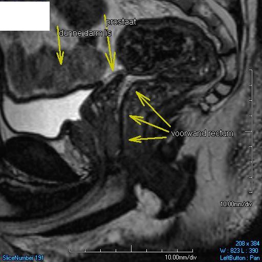 Maya Posch: MRI Mysteries