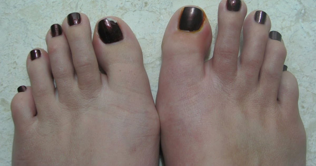Are Pedicures Bad For Your Feet at Pauline Smith blog