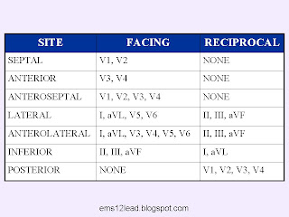 ECG help... - PA Student General Discussion - Physician Assistant Forum