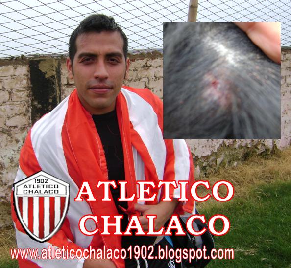 ATLETICO CHALACO - 9 de junio de 1902: CHALACO LE DIJO ADIOS A LA ...