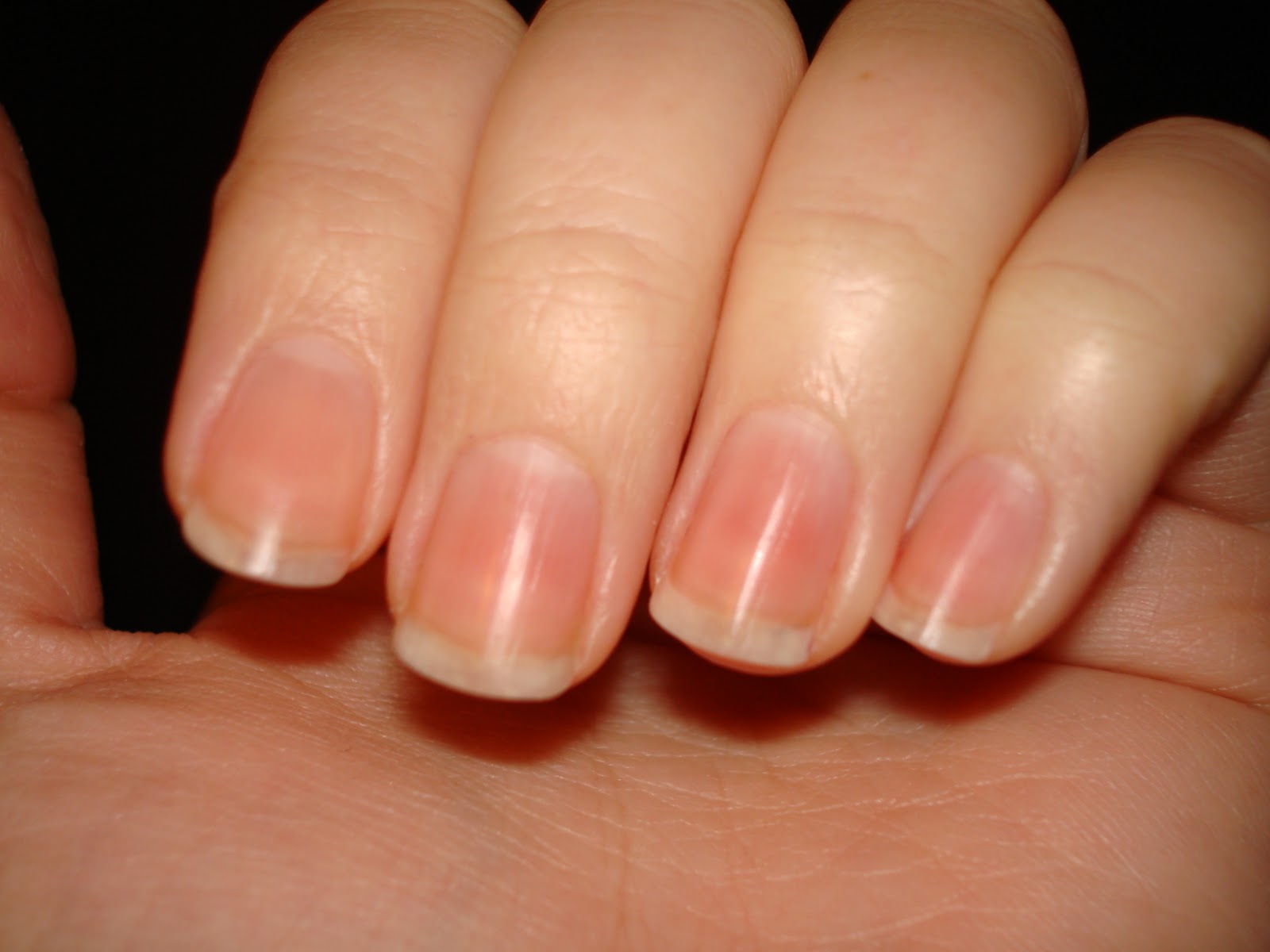 Nail it!- Nail health, tips and more