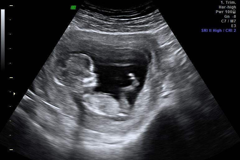 In Wonderland: 2010.09