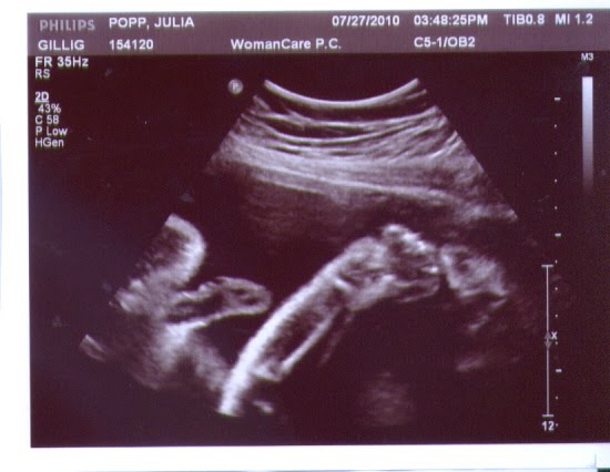Our baby step by step!!: 30 Week Scan