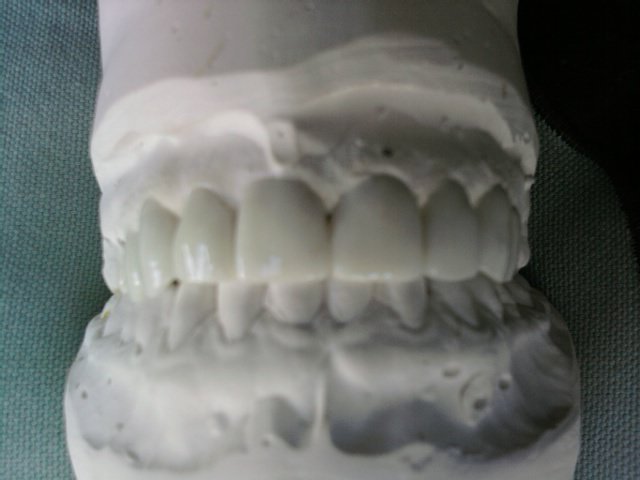 Group N "Body Modification": Maleya: Cosmetic Dentistry: Phase One