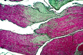 Medicine for MRCP & Medical Students: Lower limbs and Guillain Barre ...