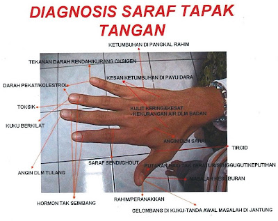 DAPUR CIK IDA: KESAN PENYAKIT MELALUI TAPAK TANGAN