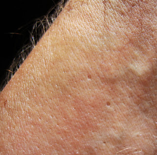 hidden experience: Tiny dots in a triangle on my left arm