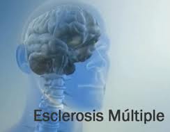 Esclerosis Múltiple