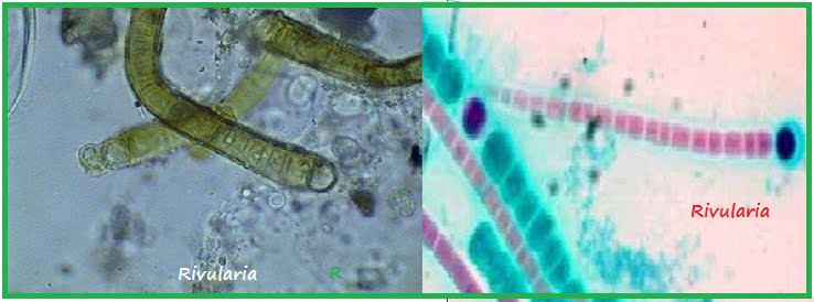 smart_ebook: Cyanobacteria (Alga Biru)